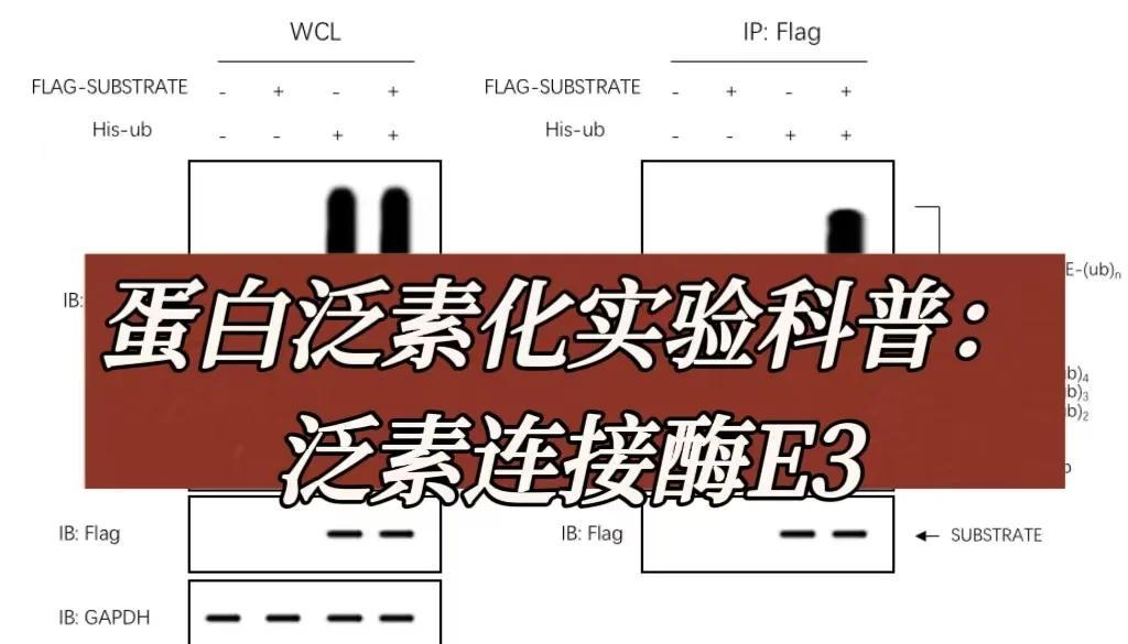 泛素连接酶E3：蛋白质泛素化的关键酶