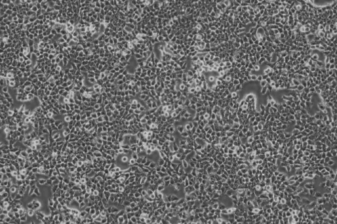 293T细胞培养小贴士