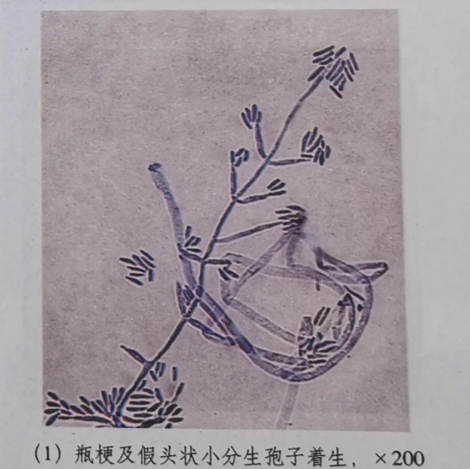 镰刀菌形态染色与培养特性