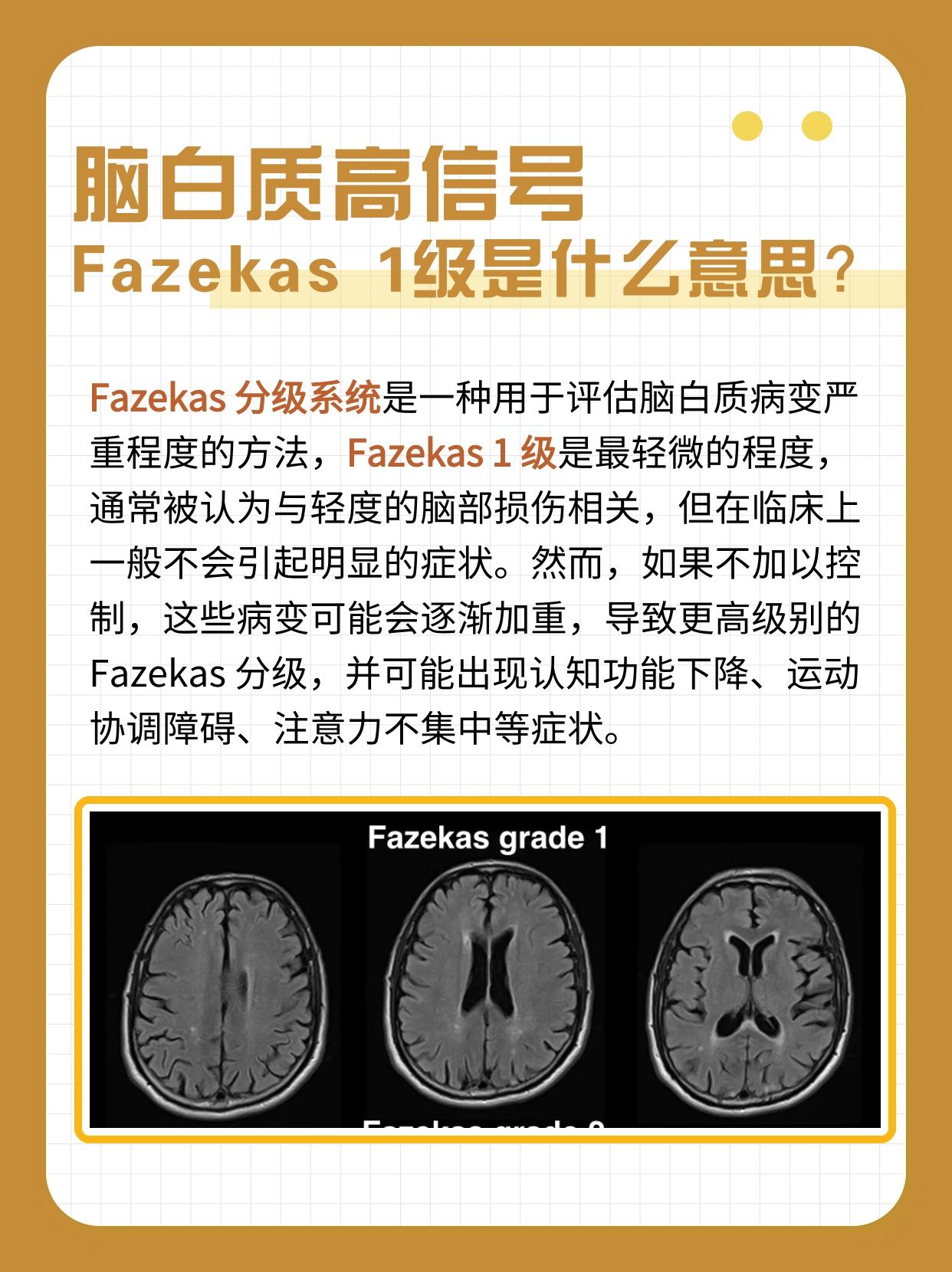 脑白质高信号Fazekas 1级什么意思？一文解答