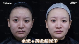 aopt超光子和m22区别？看完秒懂