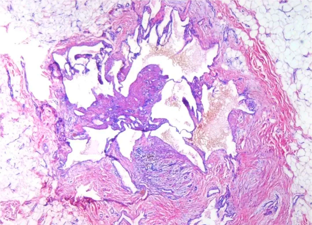 HE染色与IHC染色的区别，你了解多少？
