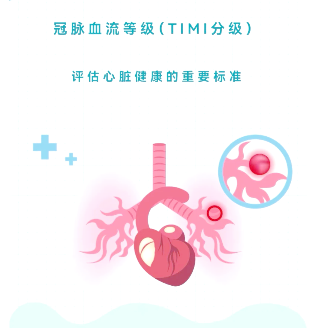 💉冠脉血流TIMI分级：了解与应对