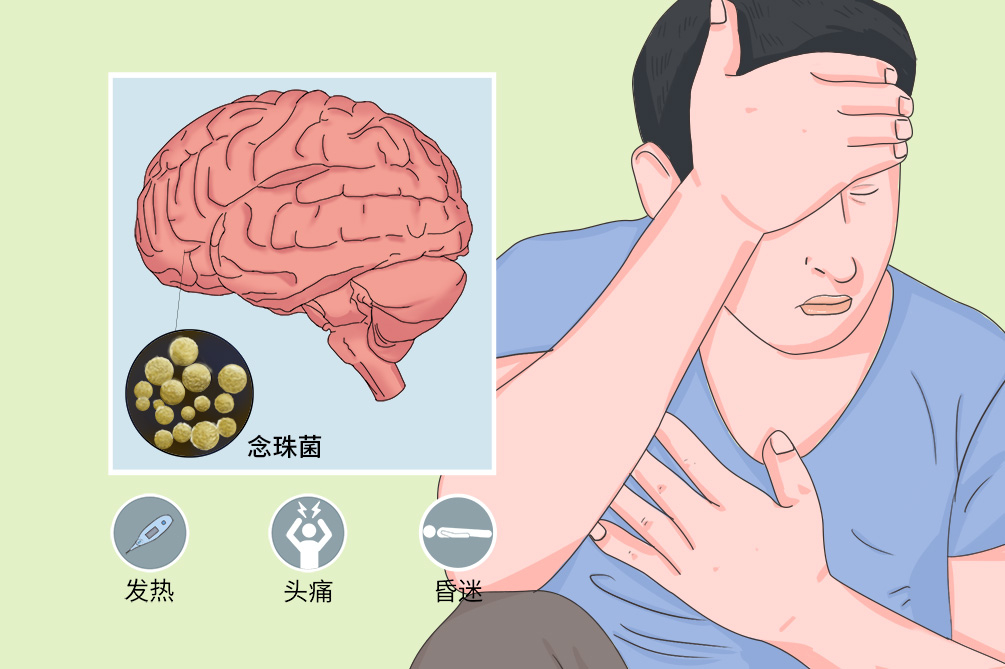 脑膜炎是什么原因引起的