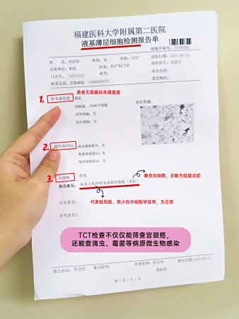 一分钟看懂TCT报告