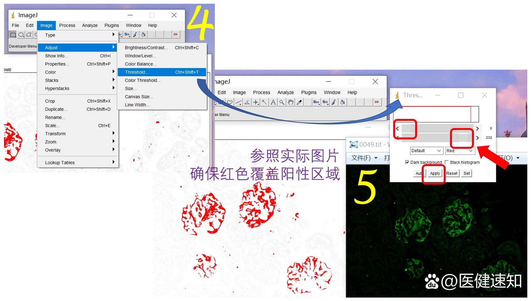 ImageJ定量分析（免疫荧光阳性面积怎么定量）