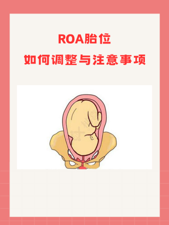 ROA胎位是什么？专家详细解答