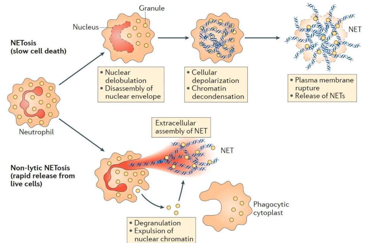 中性粒细胞的免疫杀手锏：NETs的秘密