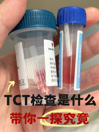 TCT检查是什么，带你一探究竟