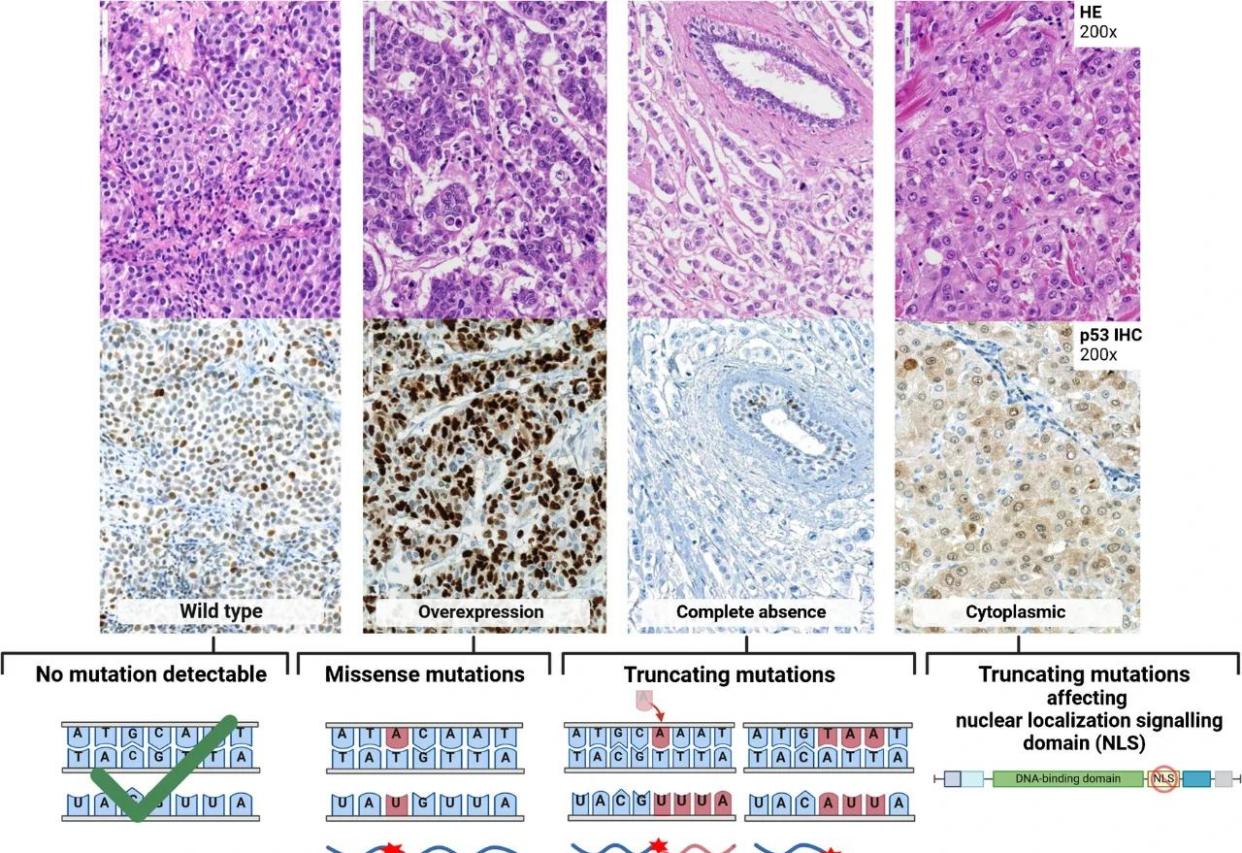 TP53基因检测的三种方法详解
