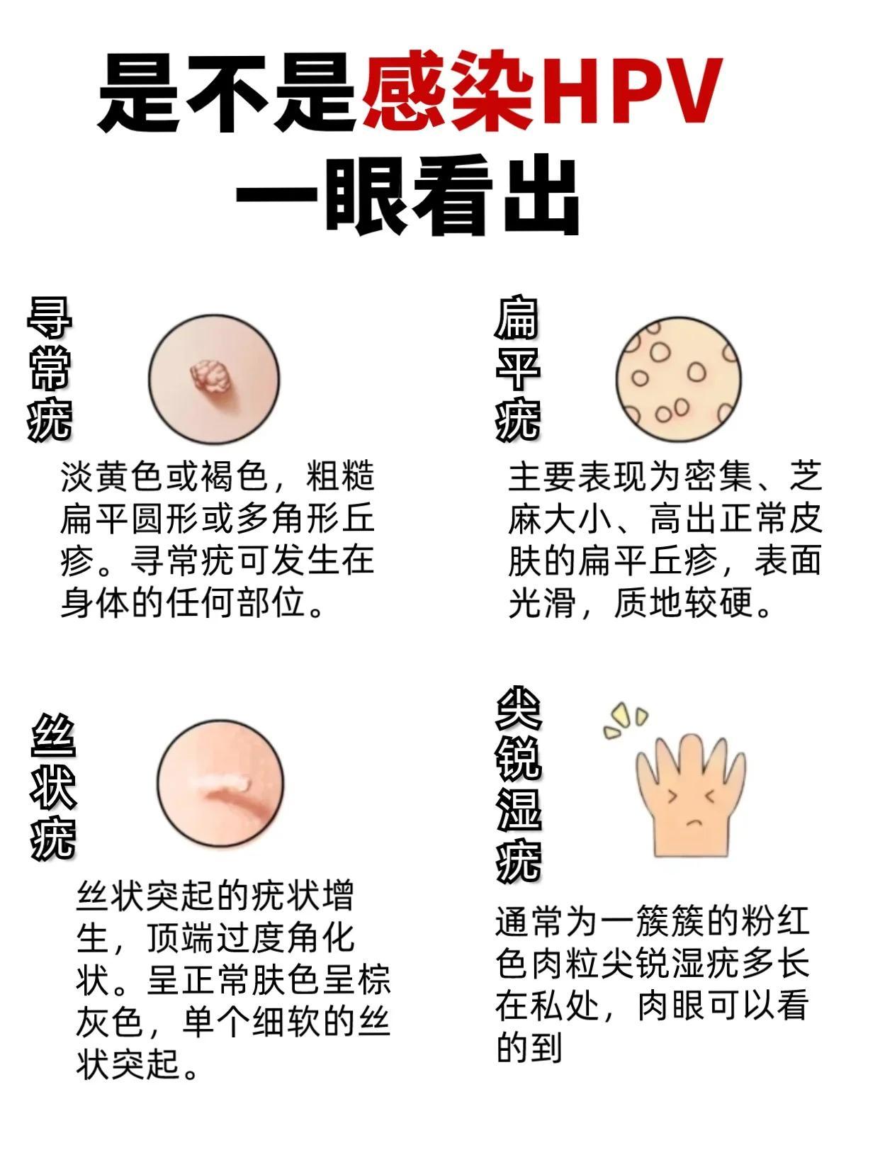 HPV感染症状与自测方法