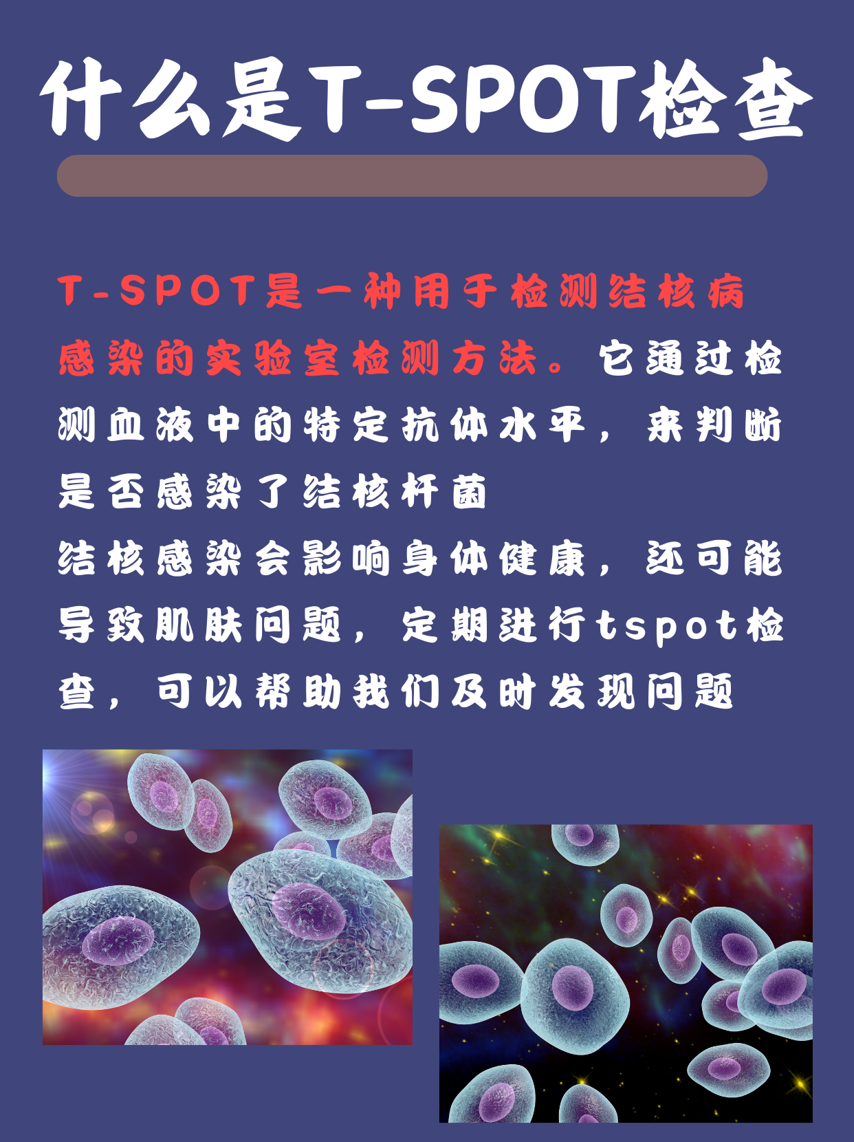 tspot检查阳性意味着什么？这篇文章来告诉你