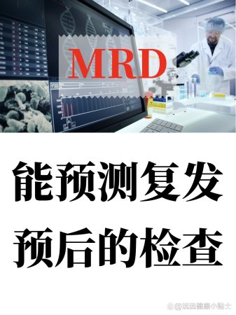 MRD检测可以预测复发和预后、指导治疗