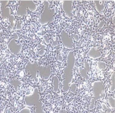 293T细胞培养全攻略：从培养基到冻存液