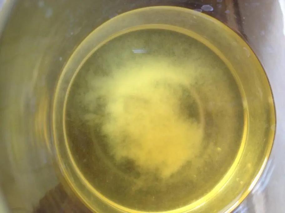 血清白色絮状沉淀的那些事儿