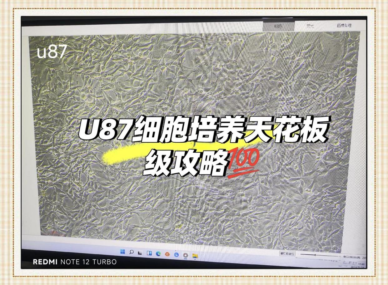 U87细胞培养，新手秒变高手！