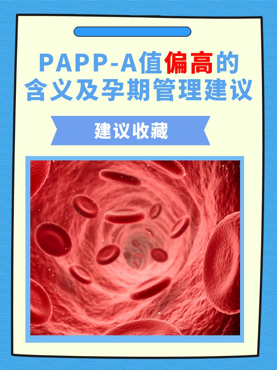 PAPP-A值偏高的含义及孕期管理建议