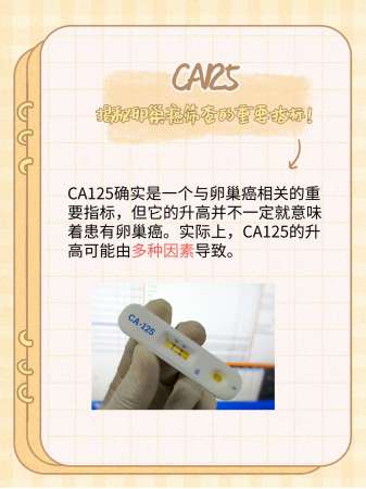 CA125：揭秘卵巢癌筛查的重要指标！