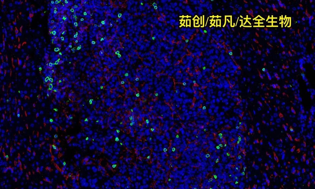 F4/80在免疫系统中的关键作用