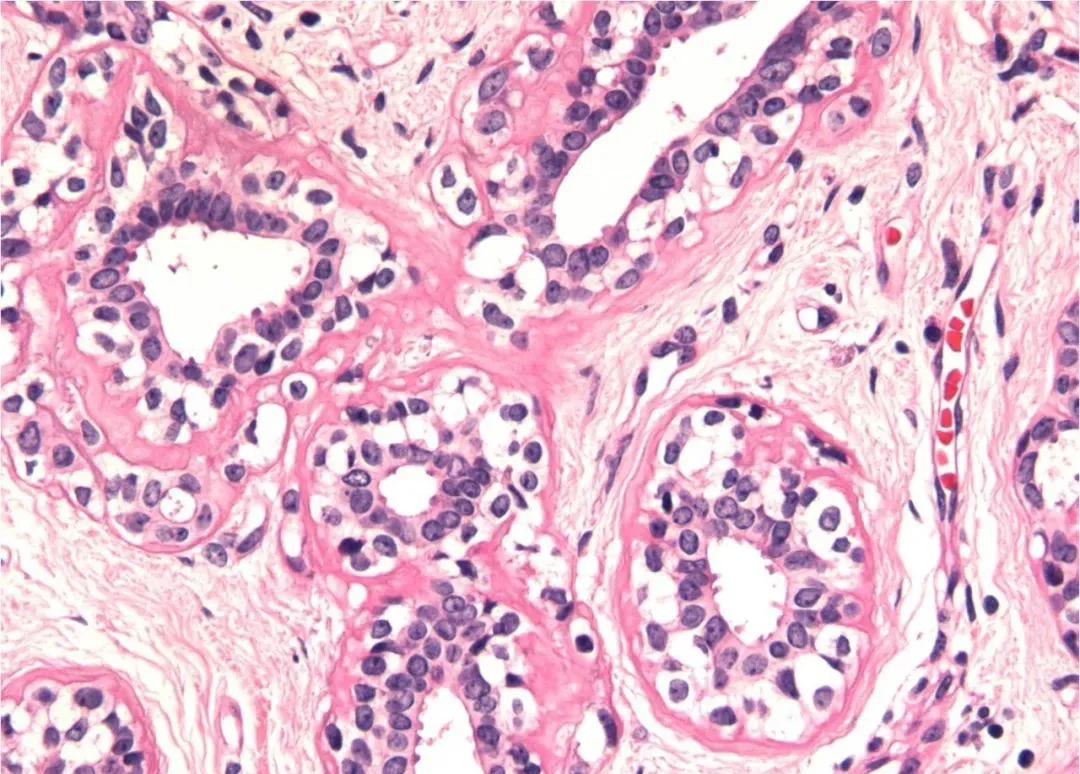HE染色与IHC染色的区别，你了解多少？