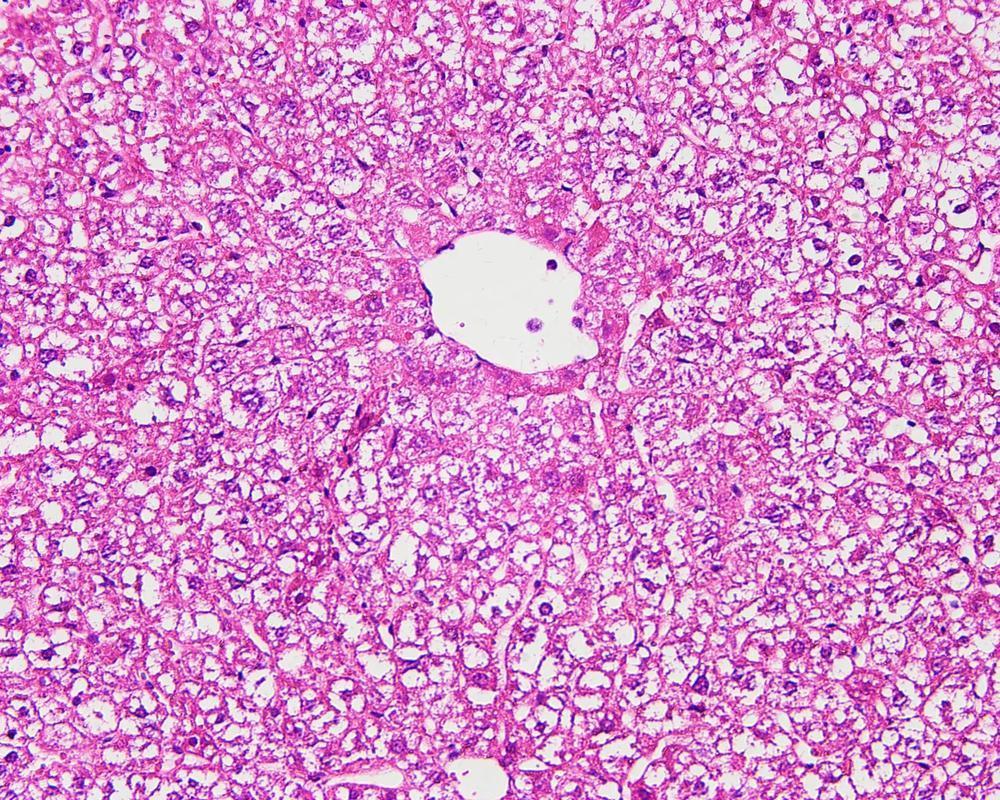 HE染色步骤与结果详解