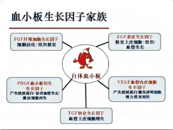 富血小板血浆竟能修复男性“早衰”，恢复勃起功能！