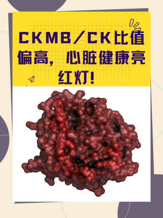 CKMB/CK比值偏高，心脏健康亮红灯！