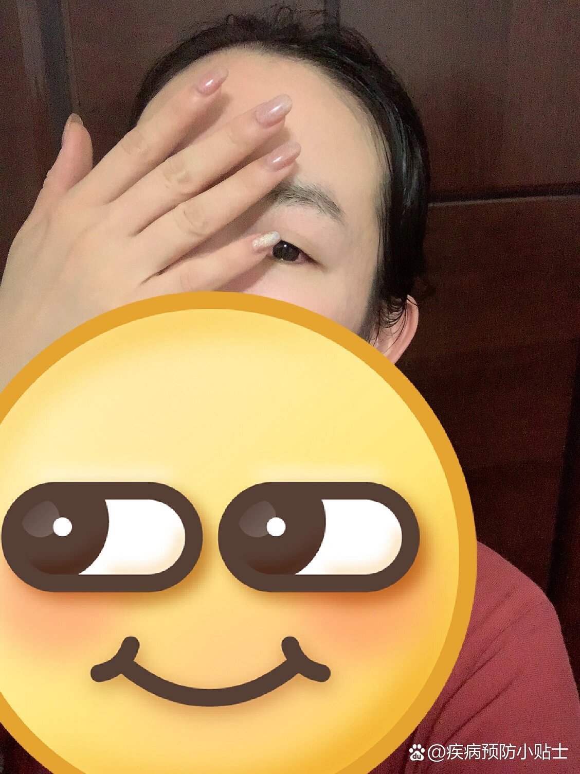 红眼病的恢复周期