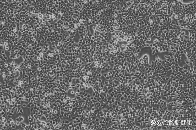 293T细胞培养小贴士