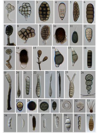 一张图告诉你真菌孢子的多样性