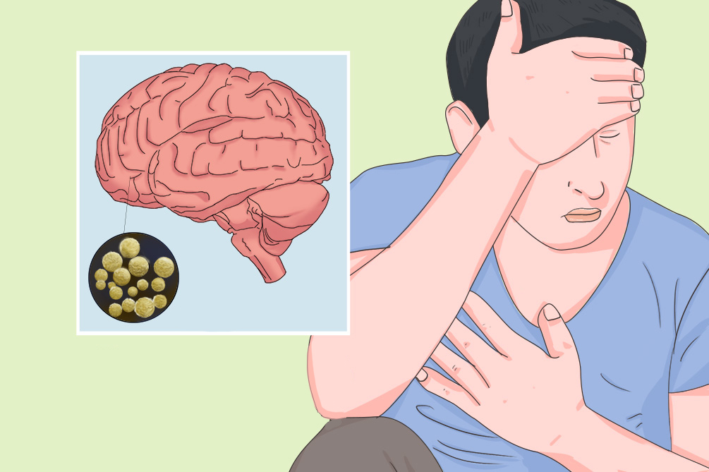 脑膜炎会传染吗