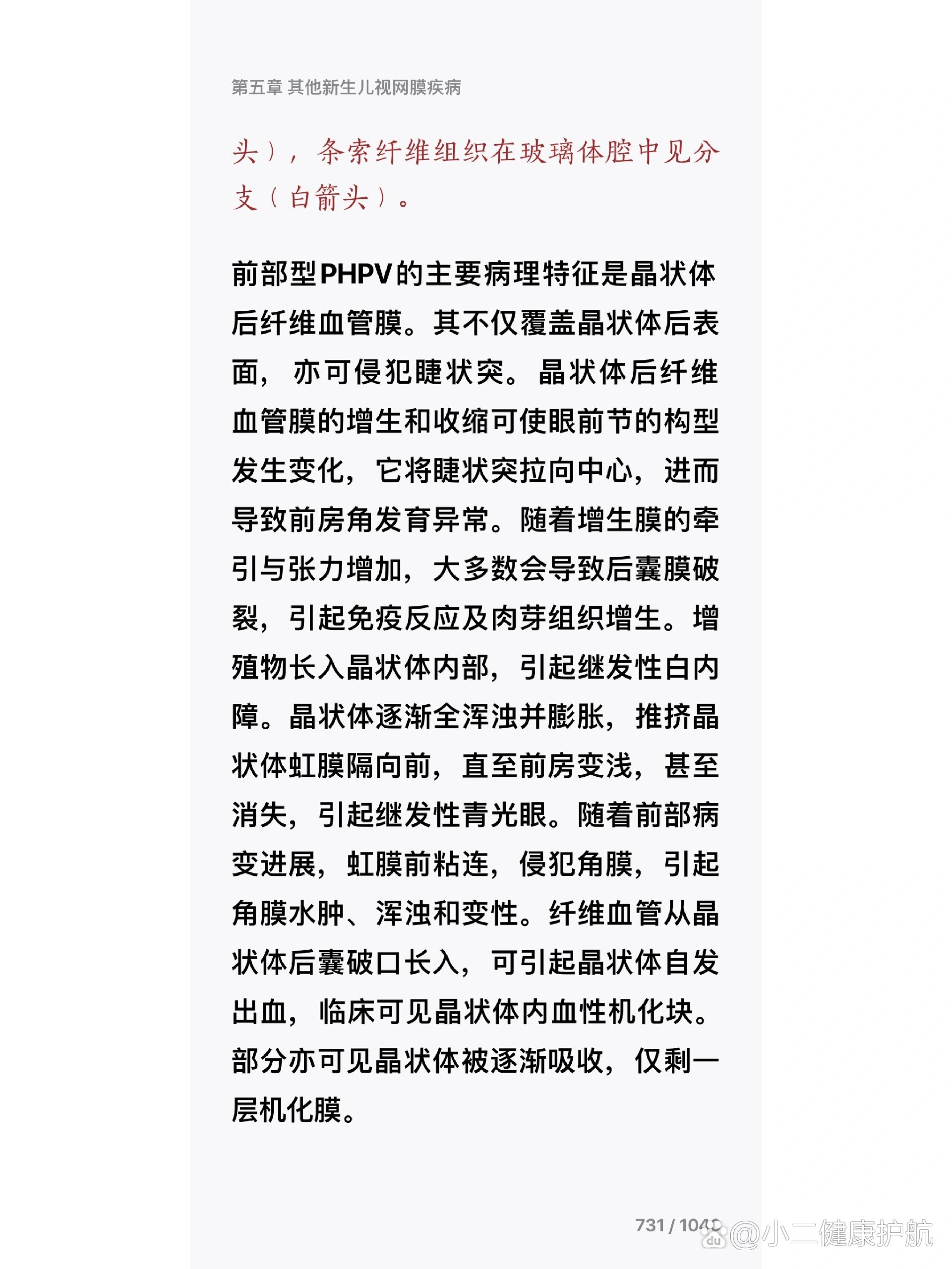 认识儿童眼病3-phpv/pfv永存原始玻璃体增生