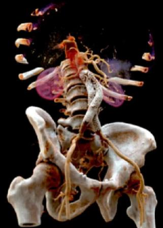 CT三维重建的多种方式