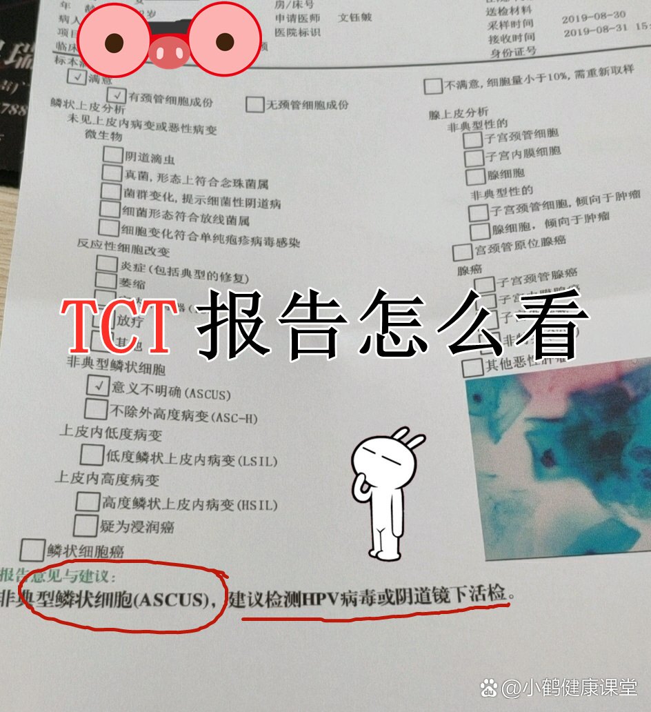 TCT报告应该如何看？