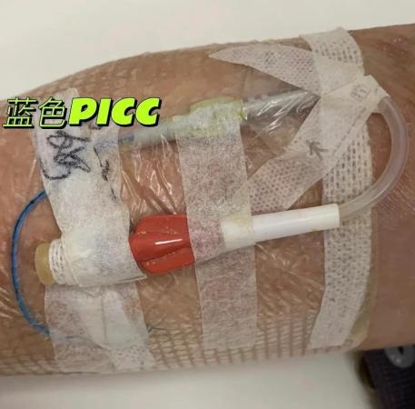 PICC、Port、CVC区别