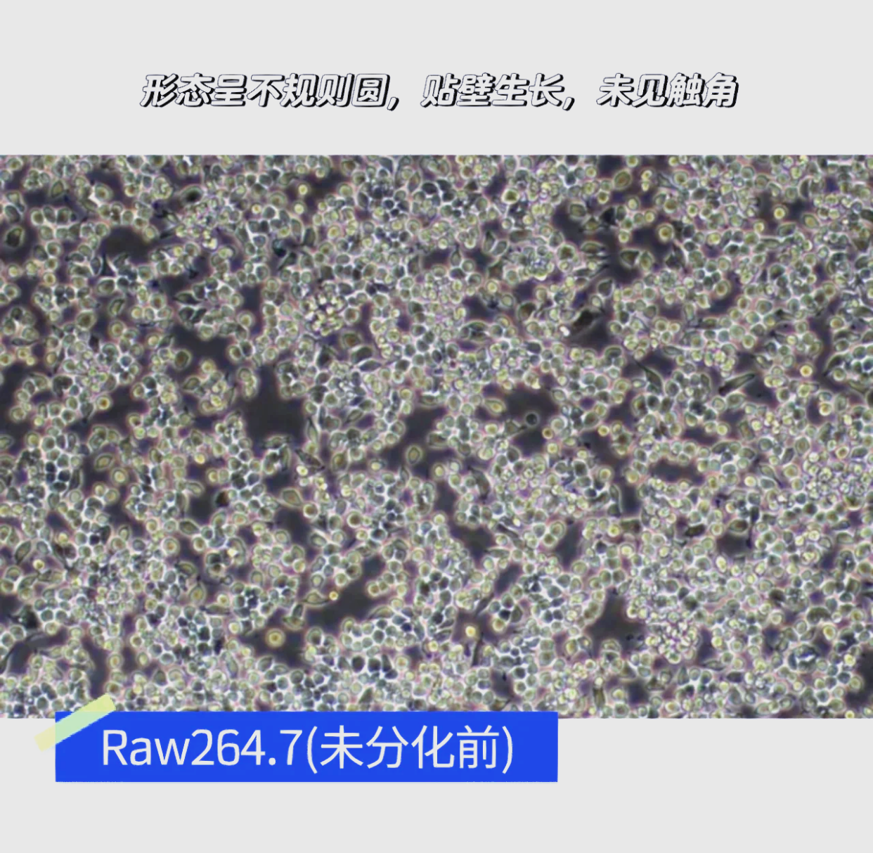 RAW264.7揭秘：巨噬细胞之谜